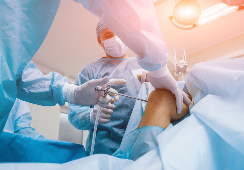 What Happens During a Knee Arthroscopy? | Dr. Jens Buelow What Happens During a Knee Arthroscopy? | Dr. Jens Buelow